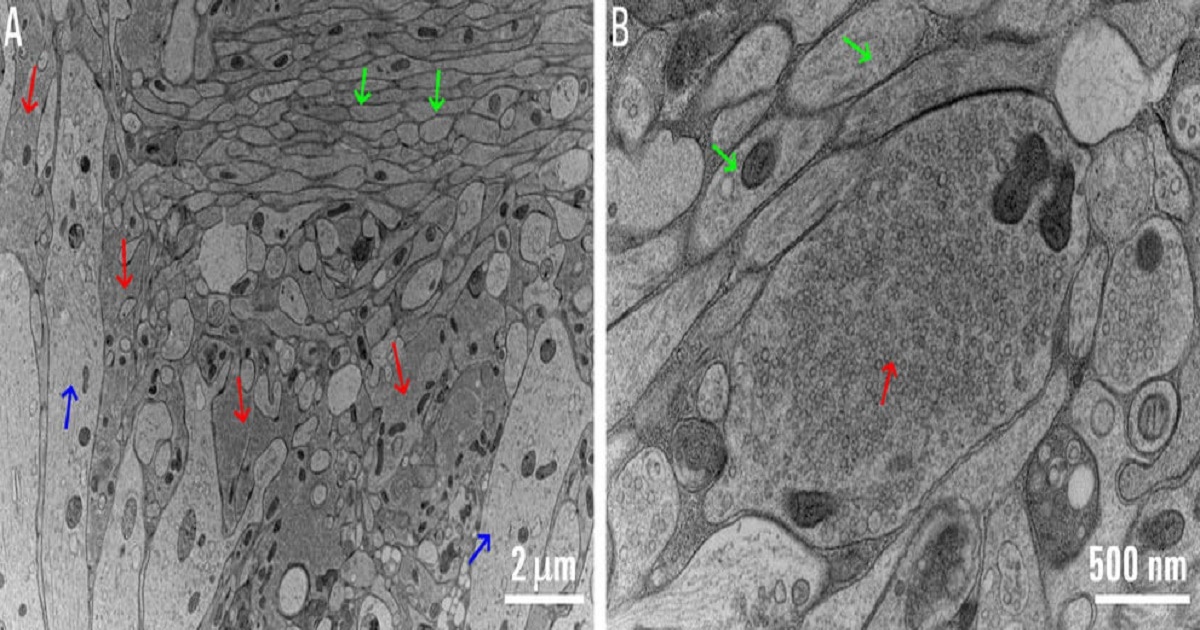 Investigating Synapses in Brain Slices With Enhanced Functional ...