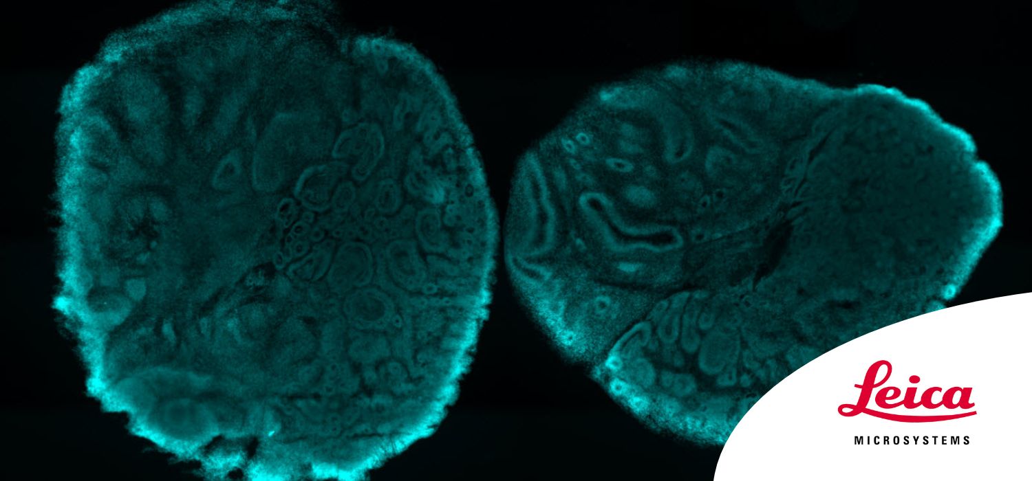 A Novel Human Brain Organoid Model to Study Microglia Phenotypes in ...