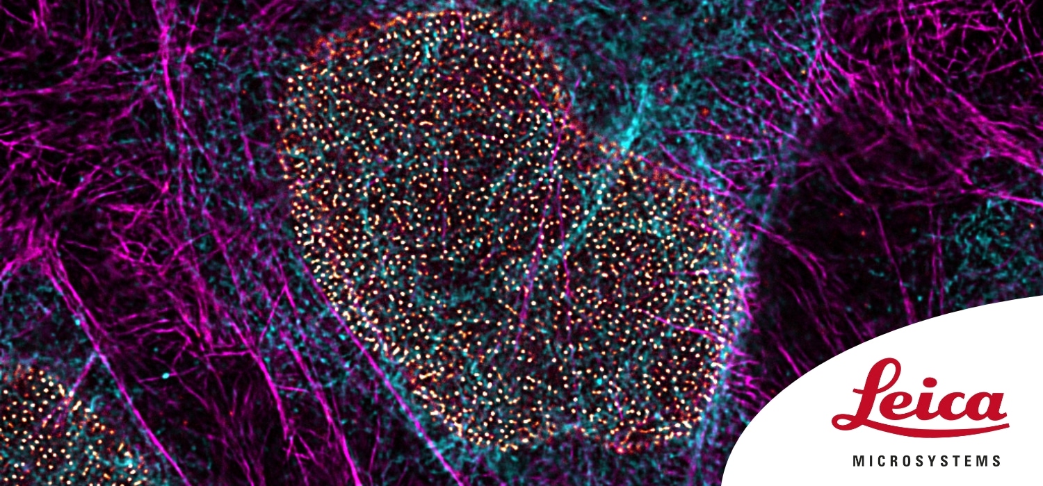 New TauSTED Tools for Gentle Live Imaging at Nanoscale Resolution ...