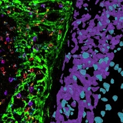 Enhancing 3D Spatial Biology with AI: Simplified Insights for All ...