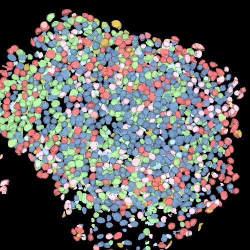 Get to Insights Faster and Easier with AI Image Analysis Tools ...